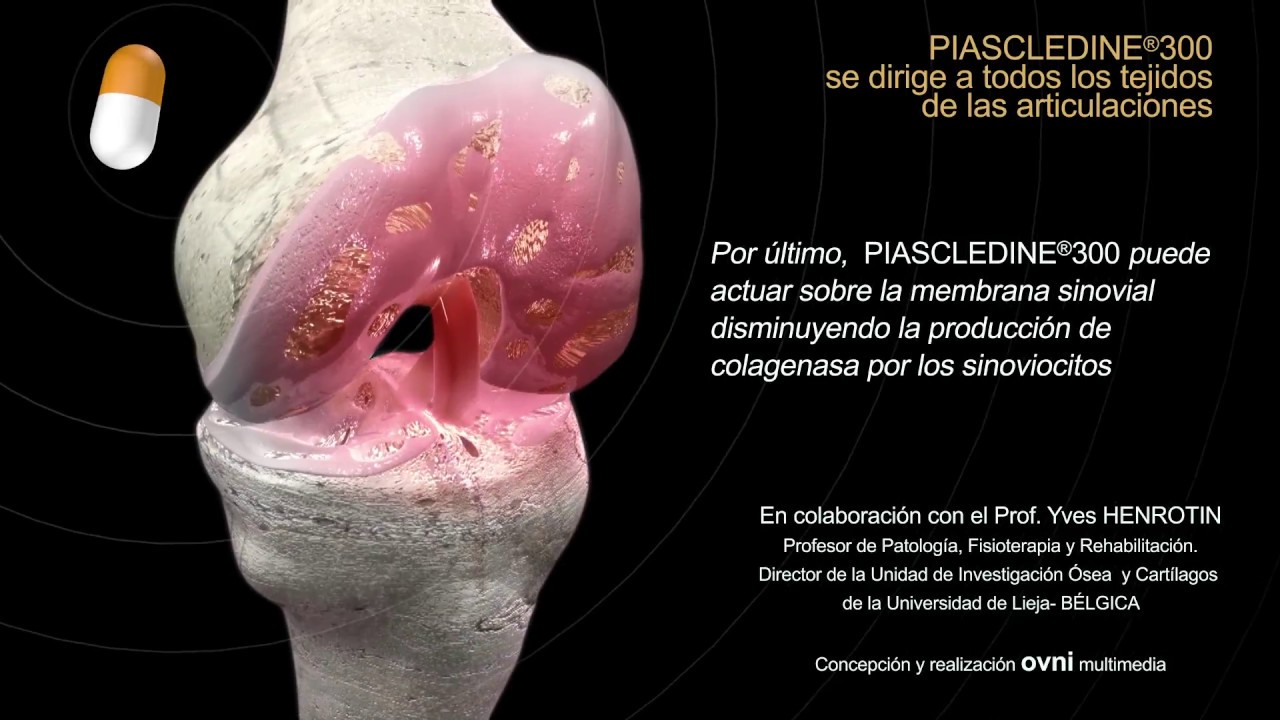 ¿Para qué se utiliza el Flexidine 300? - Vida Bio tu Web sobre Nutrición